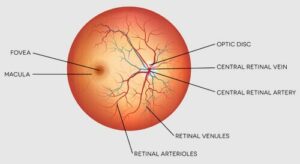 Retina Weston | Retina Specialists Bridgeport | Regional Eye